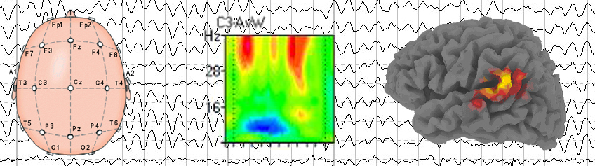 qEEG Workshop – qEEG.co.uk
